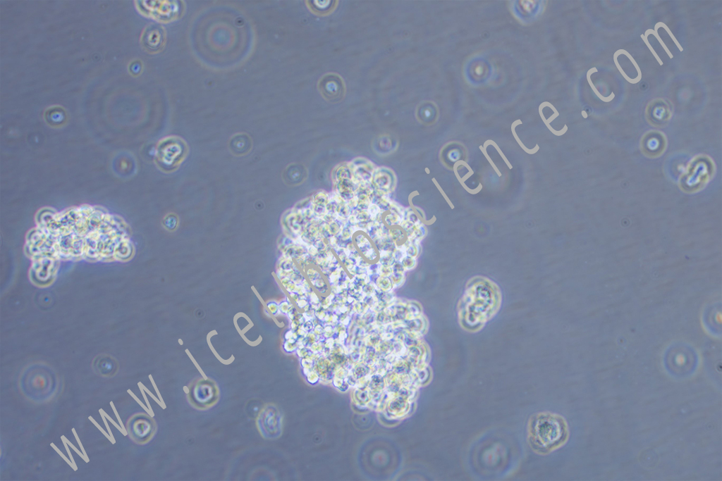 NCI-H660 人神经内分泌前列腺癌细胞-原代细胞-STR细胞-细胞培养基-镜像绮点生物