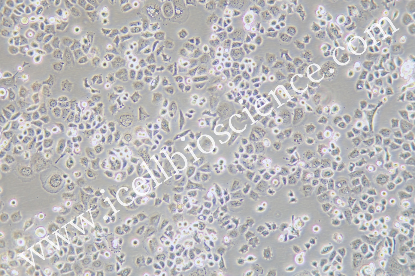 MX-1 人乳腺癌细胞-原代细胞-STR细胞-细胞培养基-镜像绮点生物