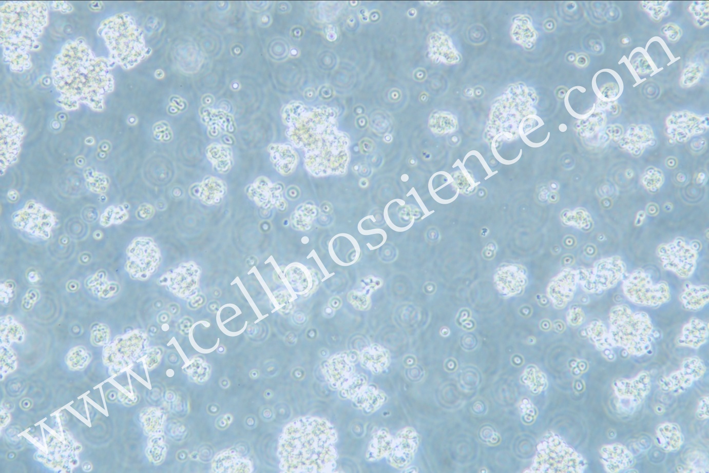 OCI-LY7 人弥漫大B细胞淋巴瘤细胞-原代细胞-STR细胞-细胞培养基-镜像绮点生物