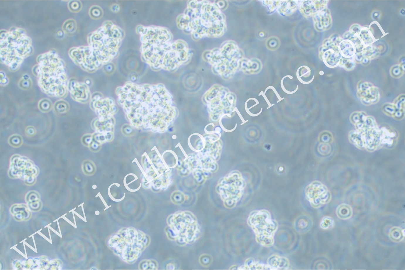 OCI-LY7 人弥漫大B细胞淋巴瘤细胞-原代细胞-STR细胞-细胞培养基-镜像绮点生物