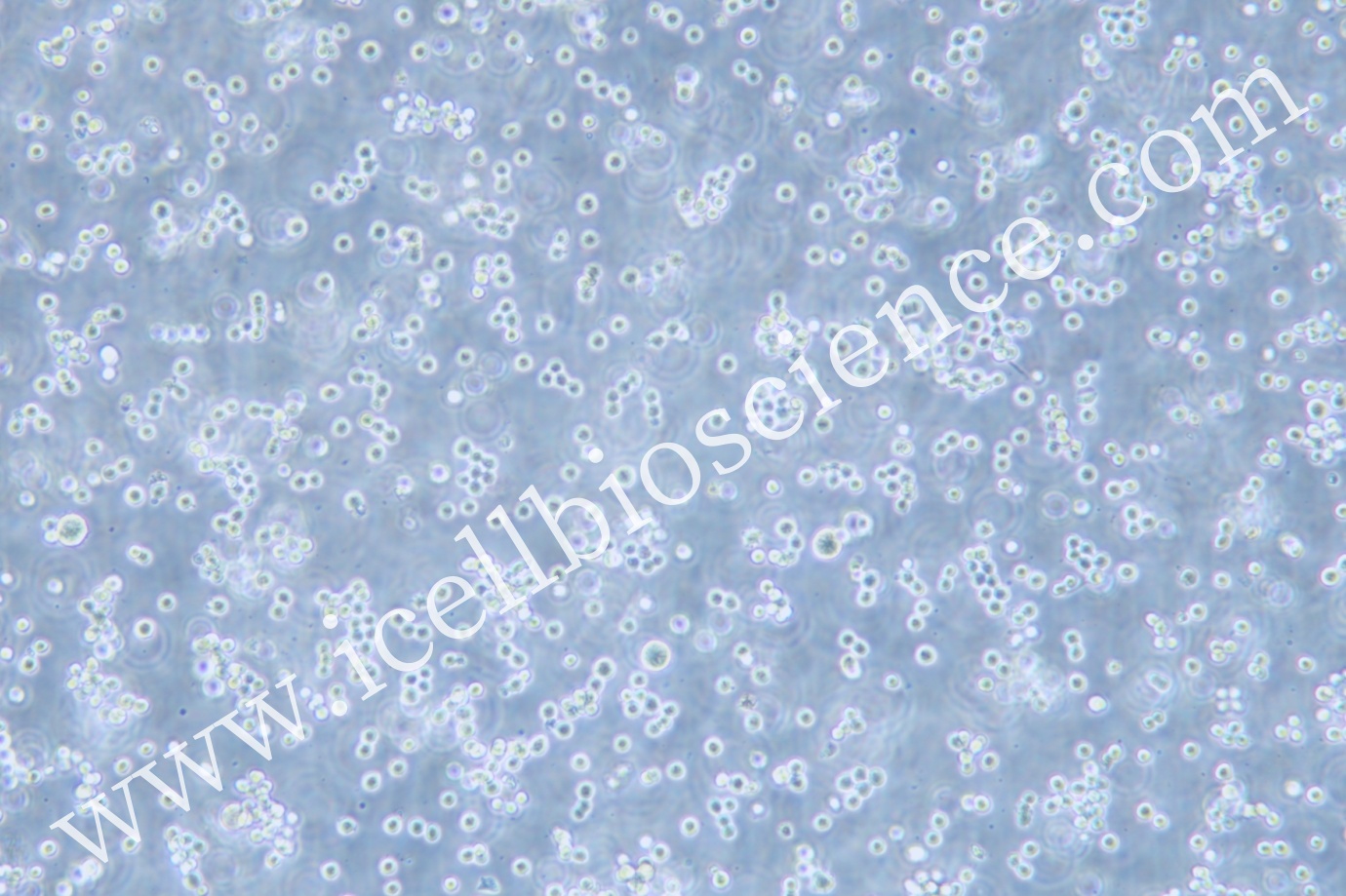 Pfeiffer 人弥漫大B细胞淋巴瘤细胞-原代细胞-STR细胞-细胞培养基-镜像绮点生物