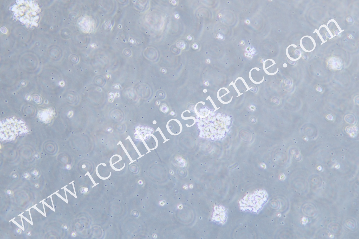 TMD8 人弥漫性大B淋巴瘤细胞-原代细胞-STR细胞-细胞培养基-镜像绮点生物