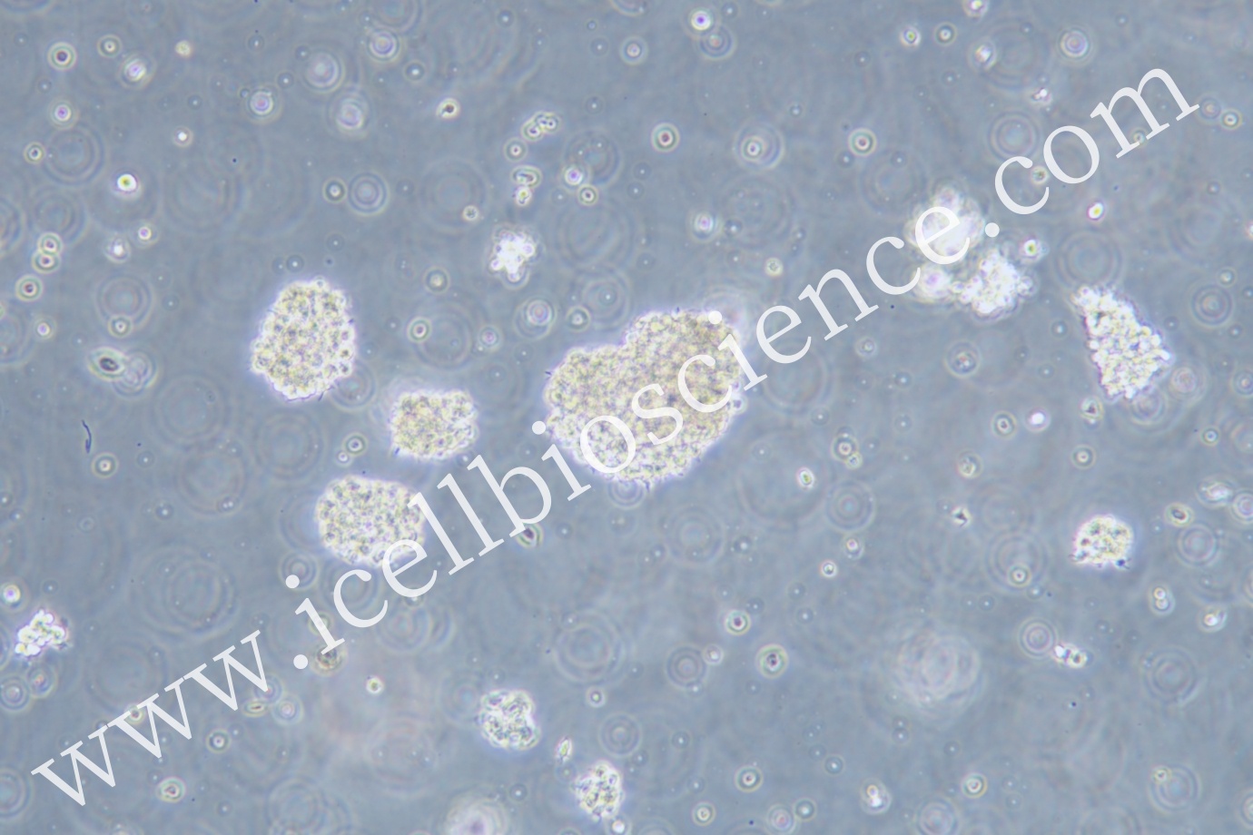TMD8 人弥漫性大B淋巴瘤细胞-原代细胞-STR细胞-细胞培养基-镜像绮点生物