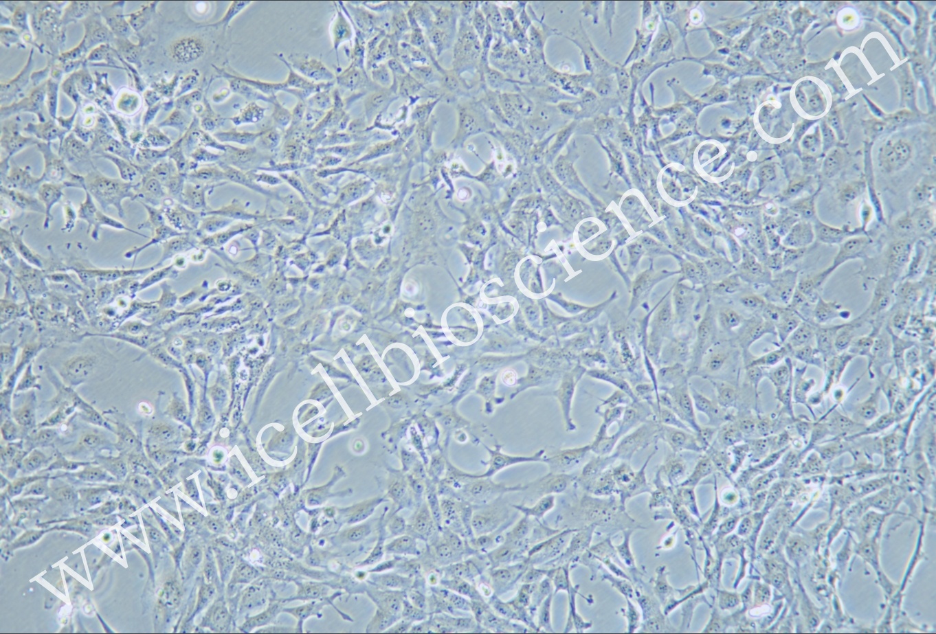 12Z 人子宫内膜异位细胞-原代细胞-STR细胞-细胞培养基-镜像绮点生物
