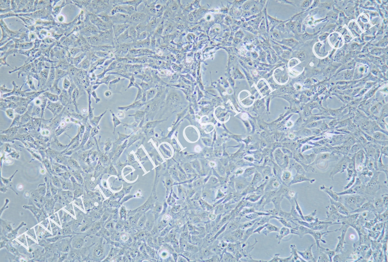 12Z 人子宫内膜异位细胞-原代细胞-STR细胞-细胞培养基-镜像绮点生物