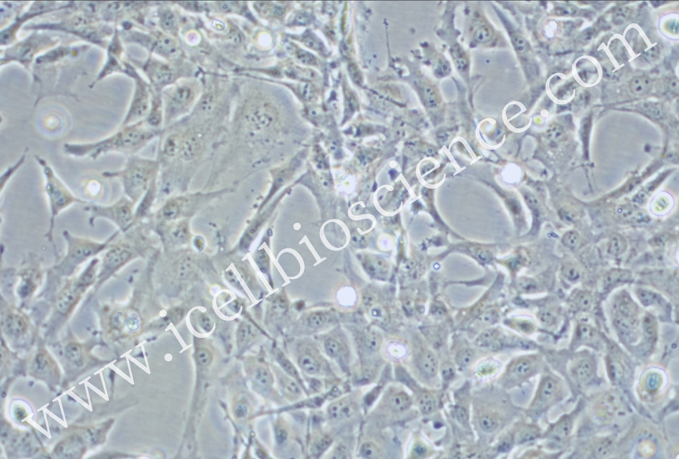 12Z 人子宫内膜异位细胞-原代细胞-STR细胞-细胞培养基-镜像绮点生物