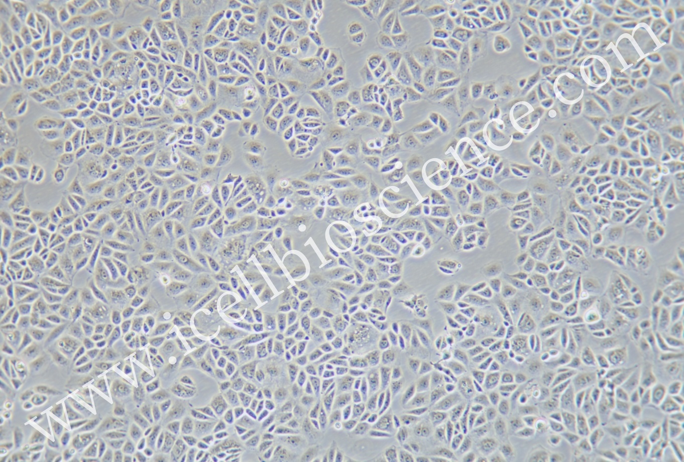 CAL-51 人乳腺癌细胞-原代细胞-STR细胞-细胞培养基-镜像绮点生物