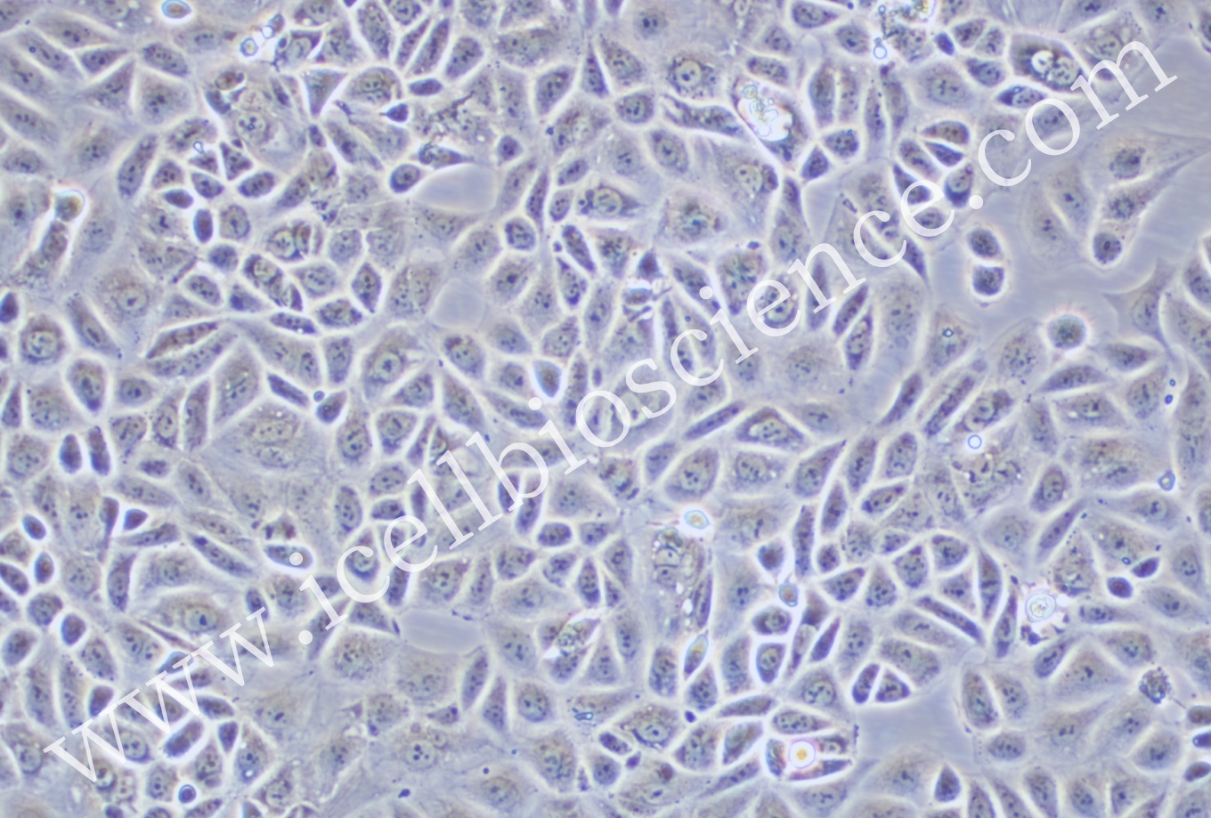 CAL-51 人乳腺癌细胞-原代细胞-STR细胞-细胞培养基-镜像绮点生物