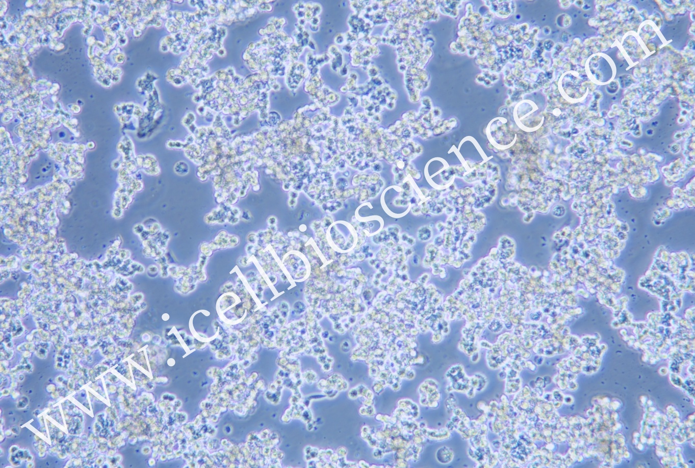 HCC1187 人乳腺癌细胞-原代细胞-STR细胞-细胞培养基-镜像绮点生物