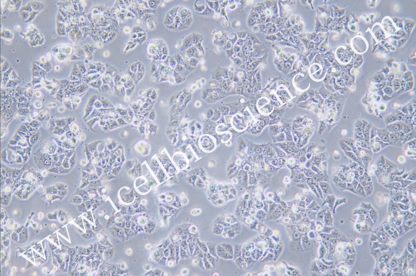 HCC1428 人乳腺导管癌细胞-原代细胞-STR细胞-细胞培养基-镜像绮点生物