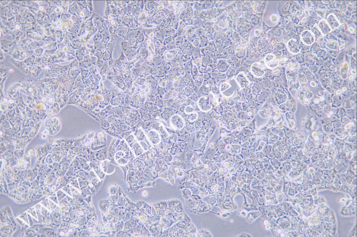 HCC1569 人乳腺癌细胞-原代细胞-STR细胞-细胞培养基-镜像绮点生物