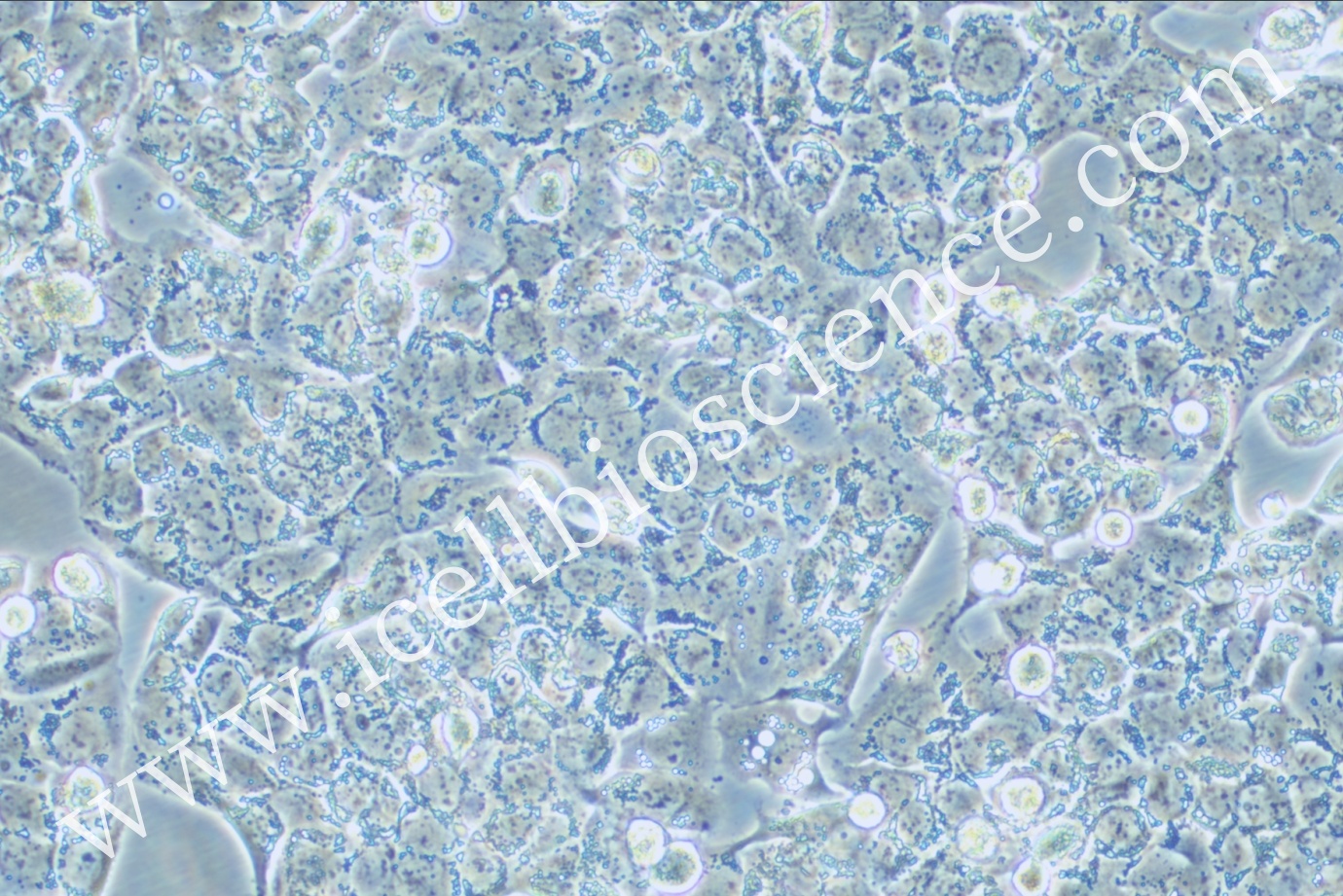 HCC1569 人乳腺癌细胞-原代细胞-STR细胞-细胞培养基-镜像绮点生物