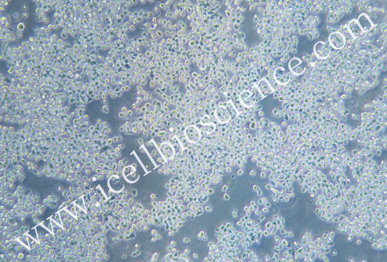 KMS-11 人骨髓瘤细胞-原代细胞-STR细胞-细胞培养基-镜像绮点生物