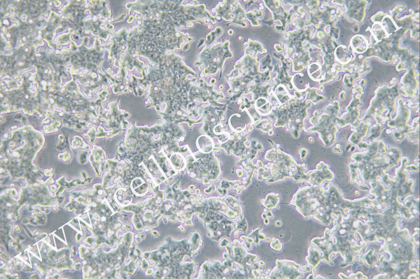 IM-95M 人胃腺癌细胞-原代细胞-STR细胞-细胞培养基-镜像绮点生物