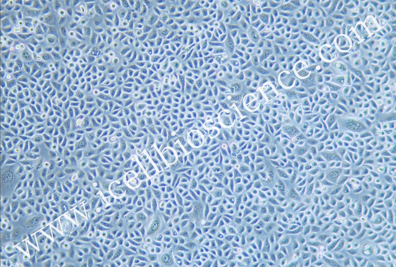 VK2/E6E7 人阴道上皮细胞-原代细胞-STR细胞-细胞培养基-镜像绮点生物