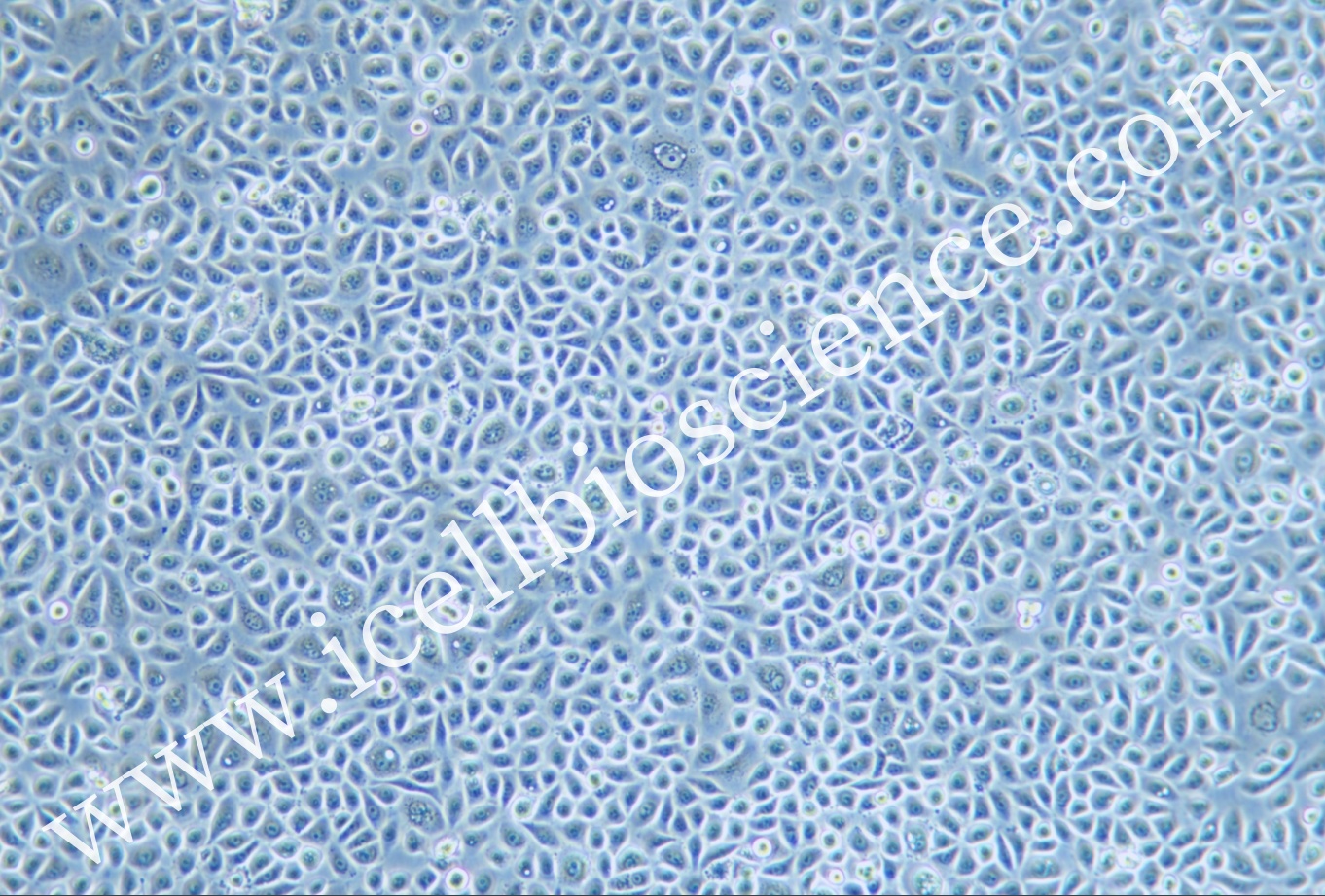 VK2/E6E7 人阴道上皮细胞-原代细胞-STR细胞-细胞培养基-镜像绮点生物