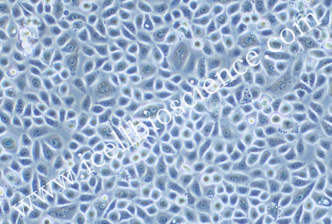 VK2/E6E7 人阴道上皮细胞-原代细胞-STR细胞-细胞培养基-镜像绮点生物
