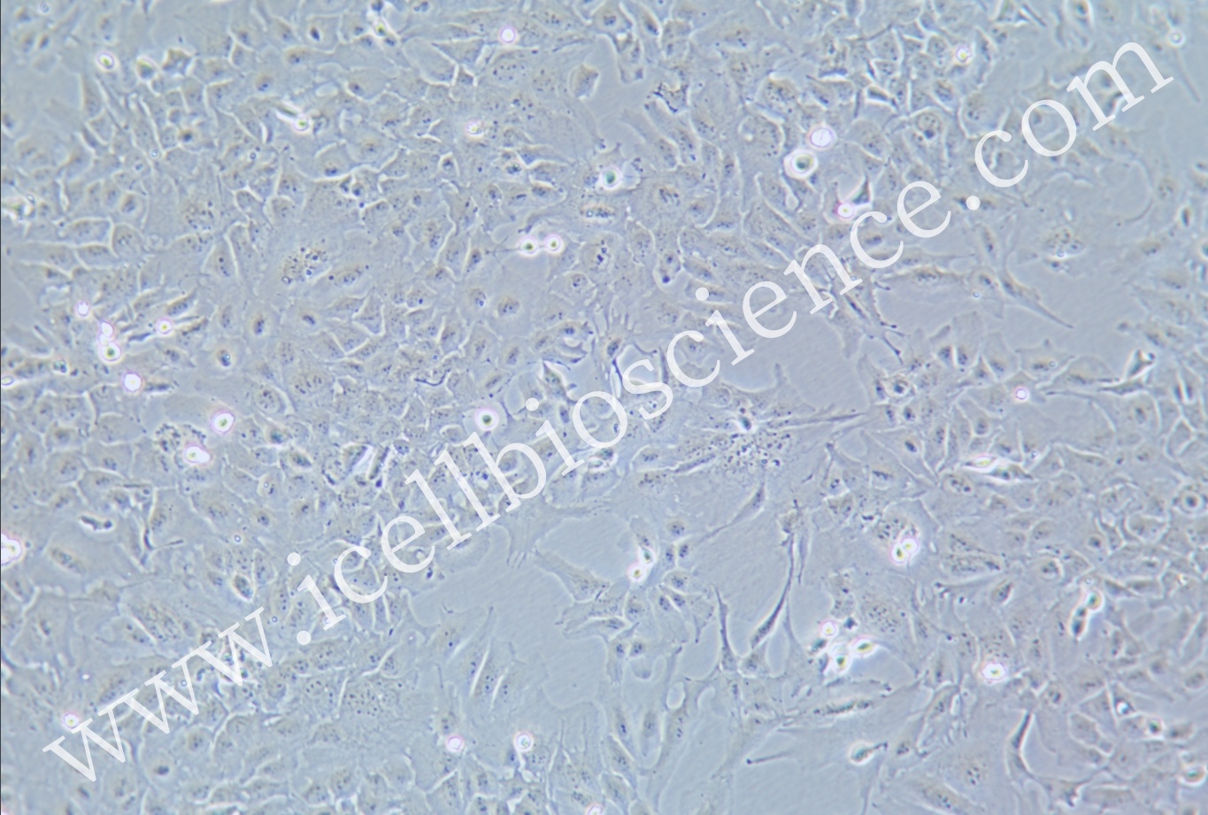SNU-761 人肝癌细胞-原代细胞-STR细胞-细胞培养基-镜像绮点生物