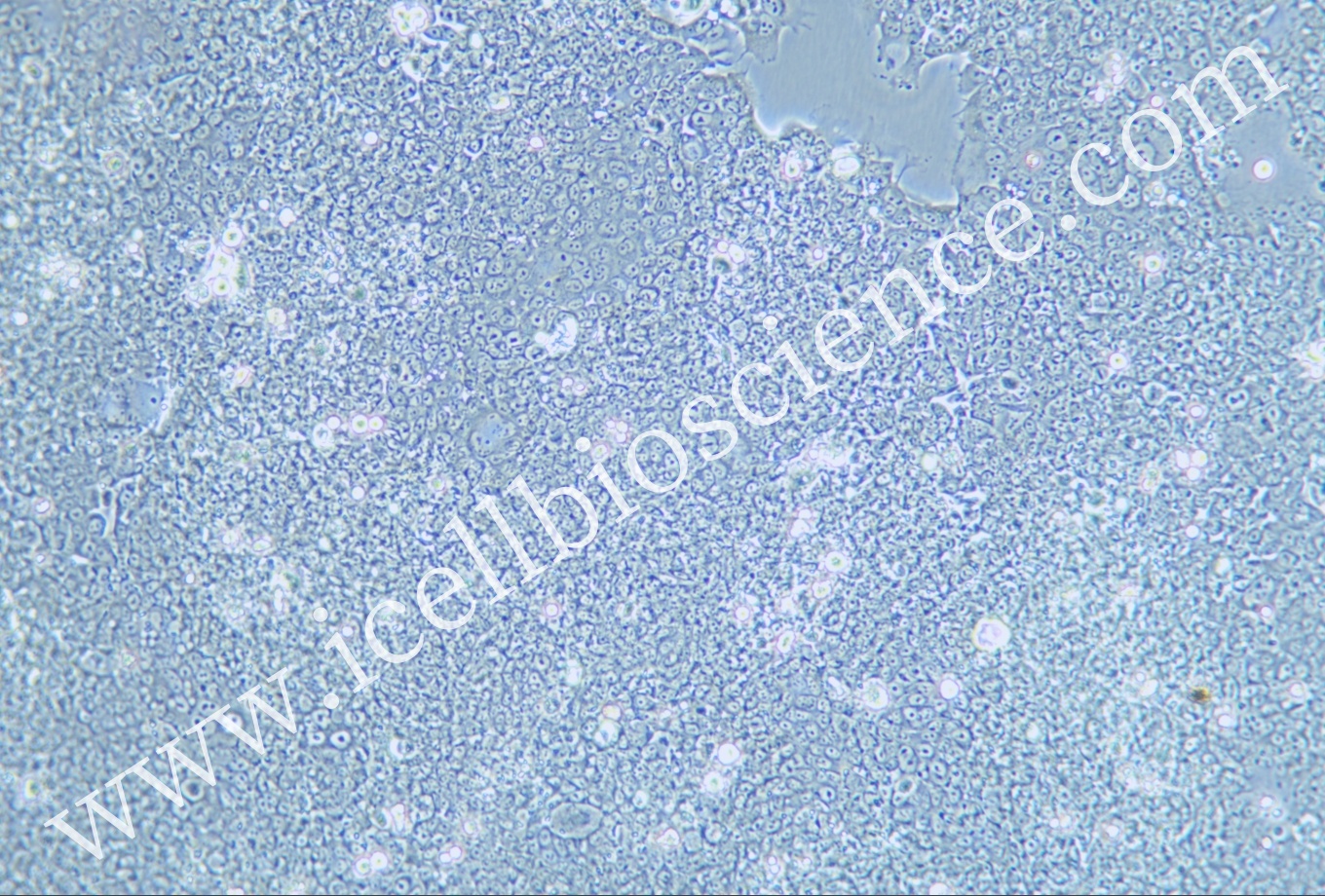 SNU-81 人结肠腺癌细胞-原代细胞-STR细胞-细胞培养基-镜像绮点生物