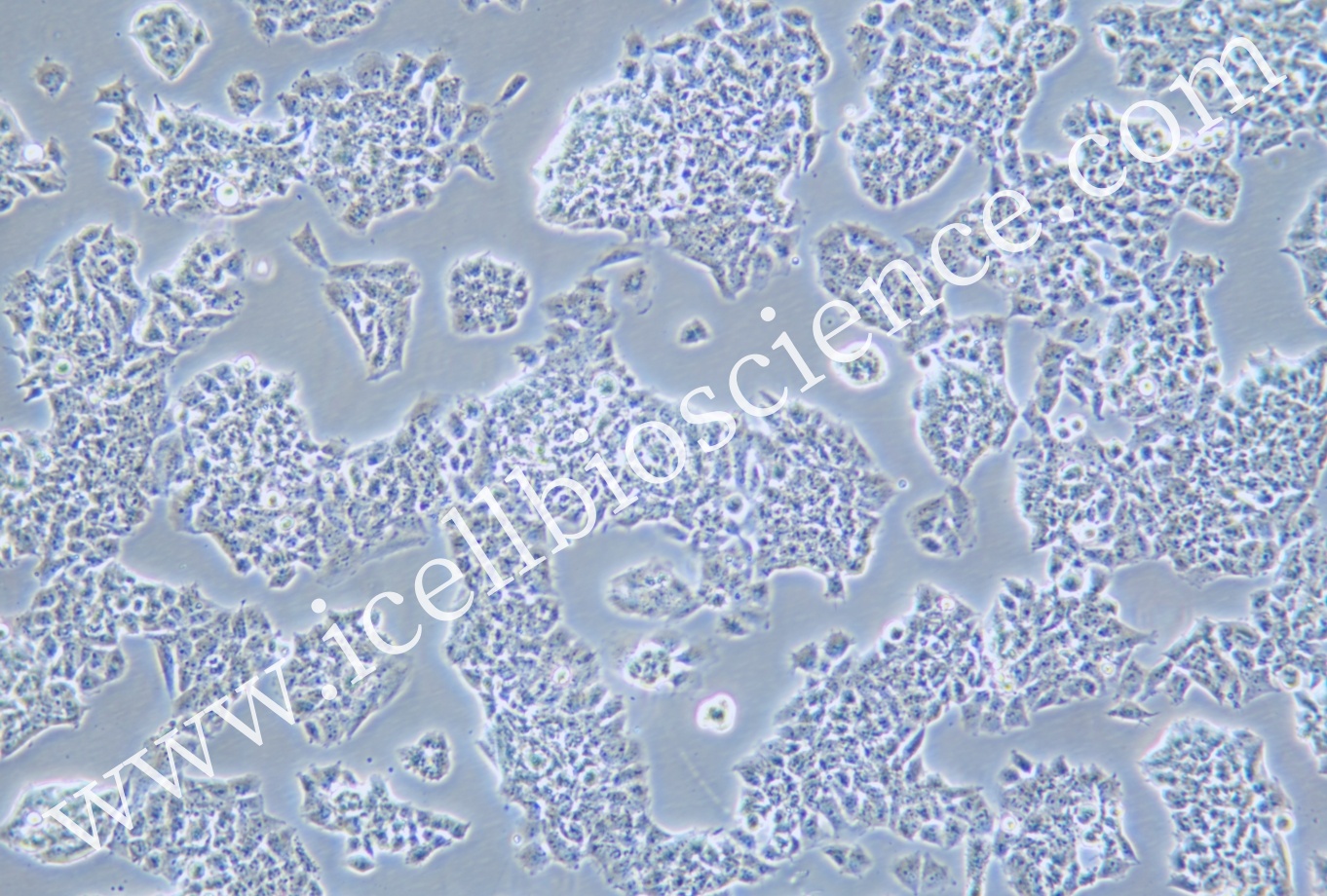 NCI-H69AR 人肺癌细胞-原代细胞-STR细胞-细胞培养基-镜像绮点生物