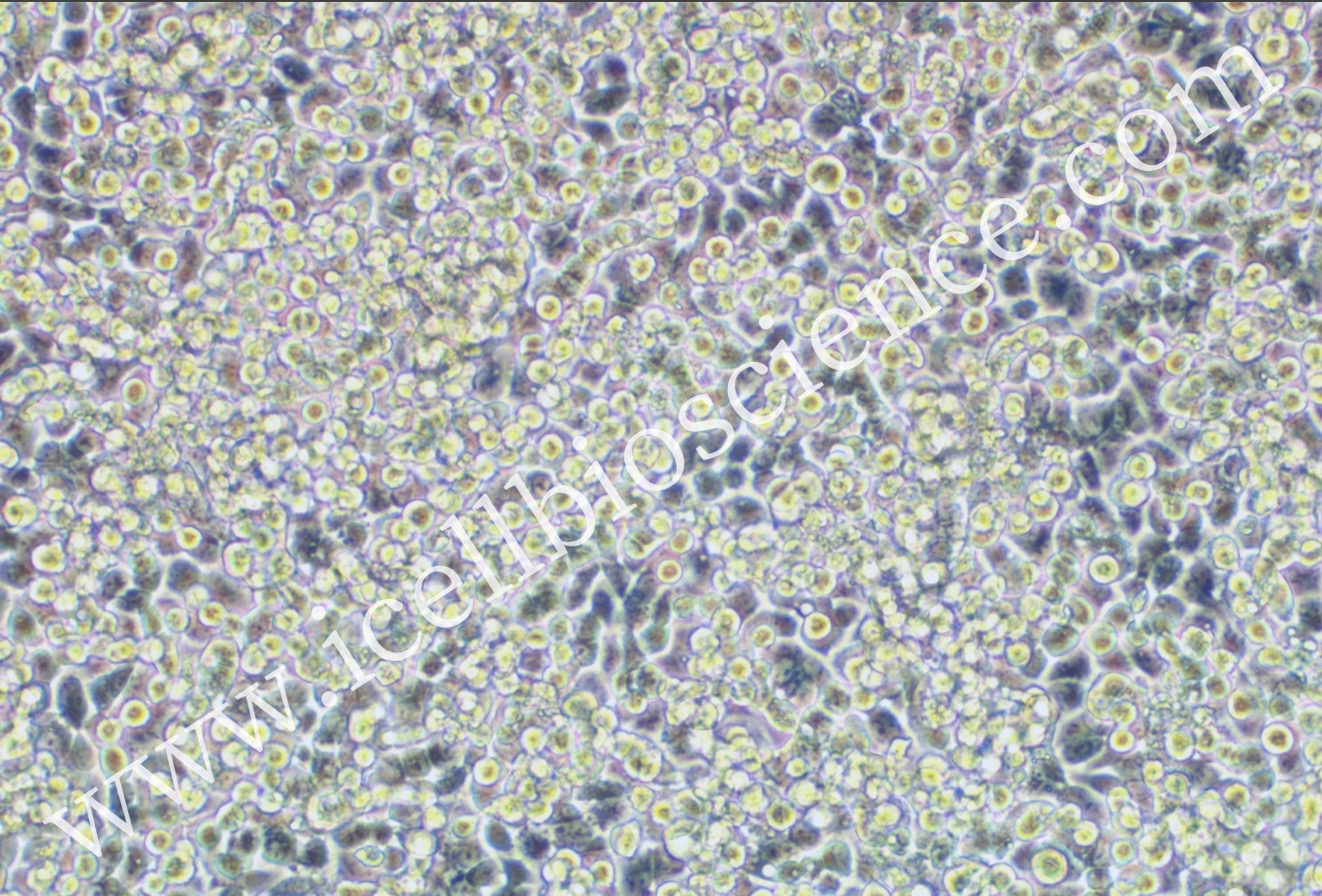 NCI-H2122 人非小细胞肺癌细胞-原代细胞-STR细胞-细胞培养基-镜像绮点生物