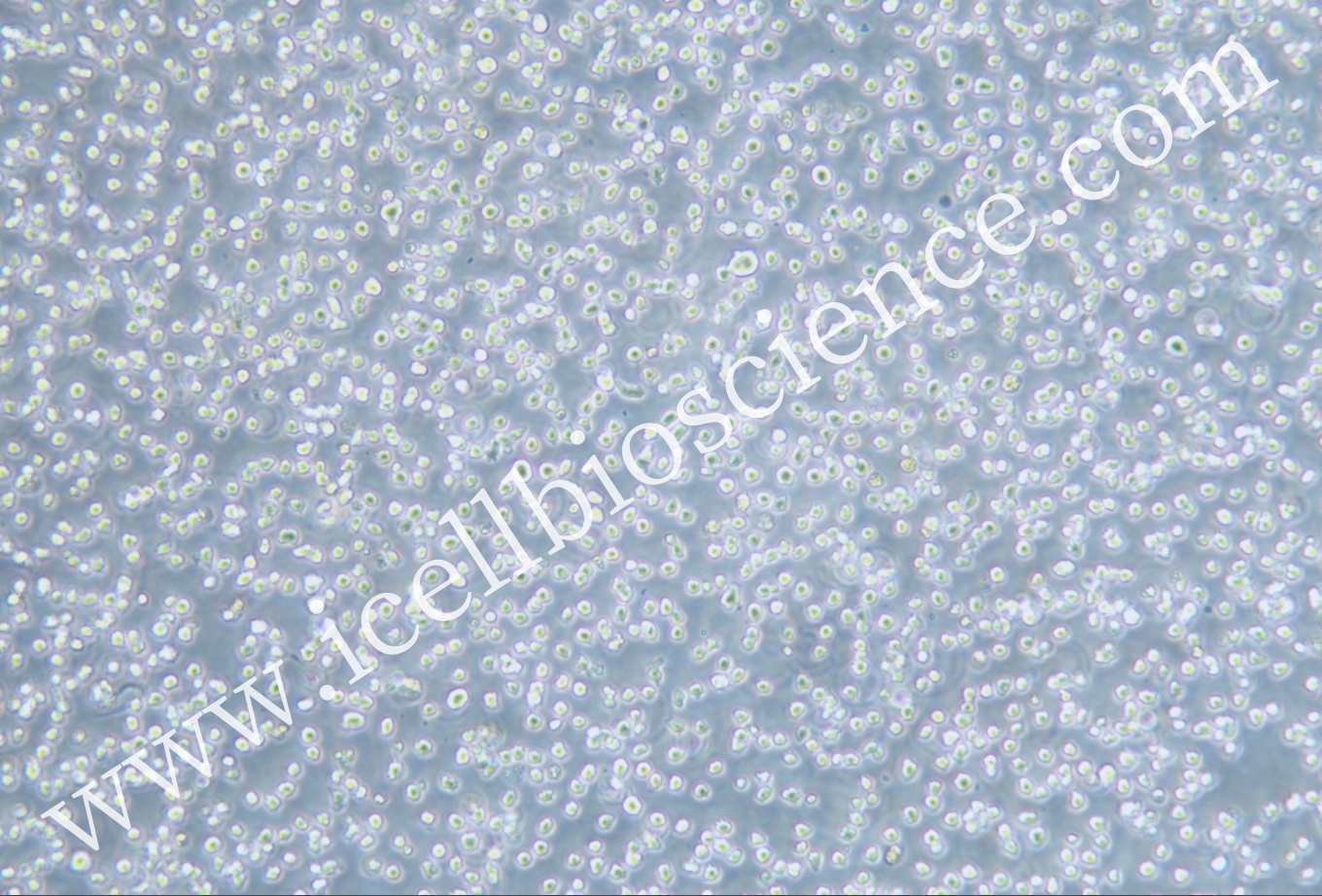 OPM2 人多发性骨髓瘤细胞-原代细胞-STR细胞-细胞培养基-镜像绮点生物
