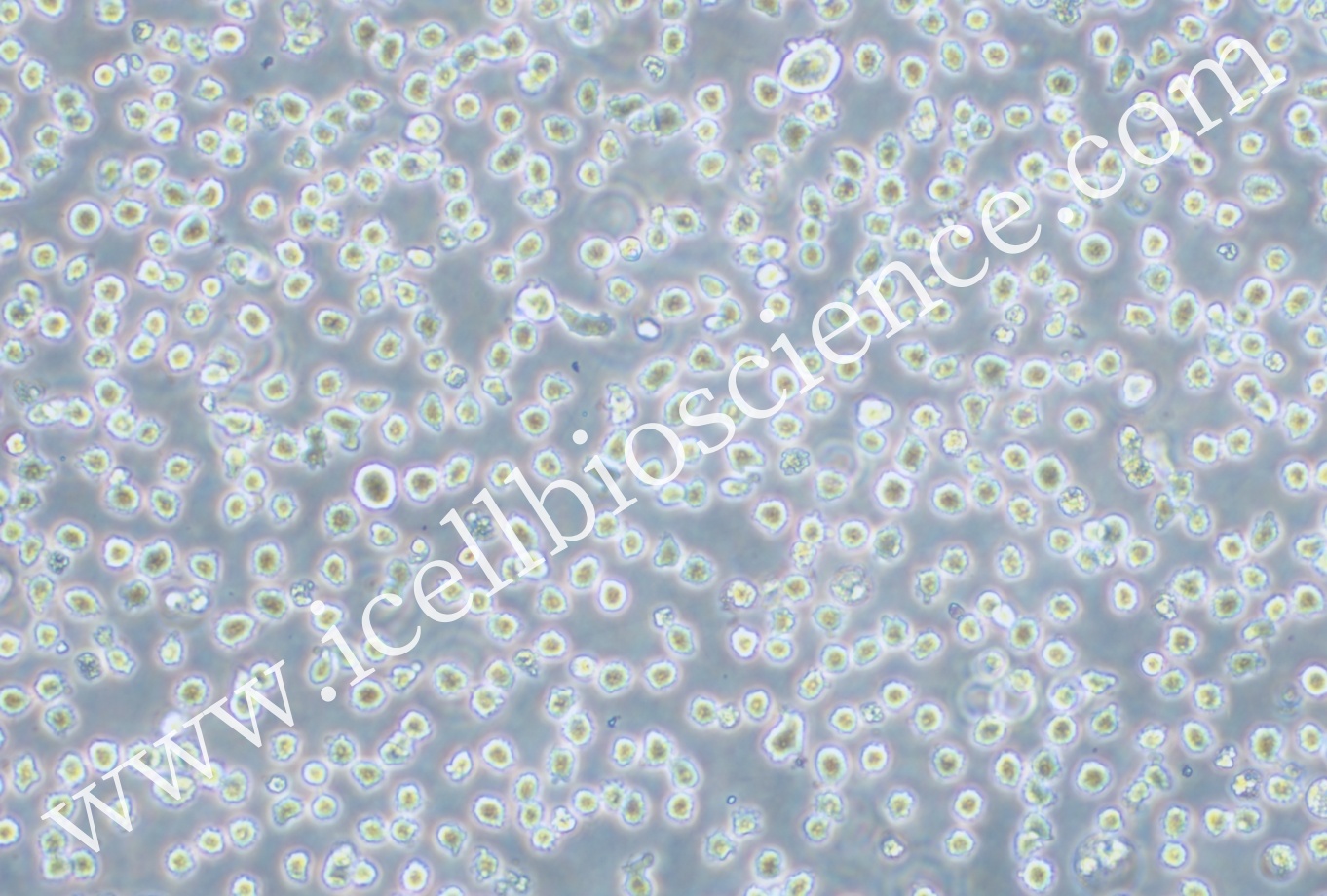 OPM2 人多发性骨髓瘤细胞-原代细胞-STR细胞-细胞培养基-镜像绮点生物