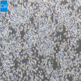RIN-M5F 大鼠β胰岛素瘤细胞-原代细胞-STR细胞-细胞培养基-镜像绮点生物