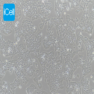 A673 人横纹肌瘤细胞-原代细胞-STR细胞-细胞培养基-镜像绮点生物