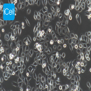 AsPC-1 人转移胰腺腺癌细胞-原代细胞-STR细胞-细胞培养基-镜像绮点生物