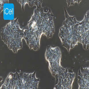 BT-474 人乳腺导管癌细胞-原代细胞-STR细胞-细胞培养基-镜像绮点生物