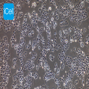Caov-3 人卵巢癌细胞-原代细胞-STR细胞-细胞培养基-镜像绮点生物