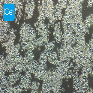 COLO320 人结直肠腺癌细胞-原代细胞-STR细胞-细胞培养基-镜像绮点生物