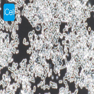 COLO320 DM人结直肠腺癌细胞-原代细胞-STR细胞-细胞培养基-镜像绮点生物