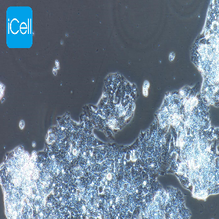 GS-HEPG2 人肝癌细胞亚型-原代细胞-STR细胞-细胞培养基-赛百慷生物