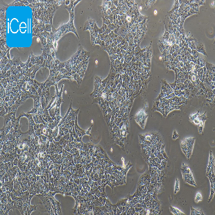 HCC827 人非小细胞肺癌细胞-原代细胞-STR细胞-细胞培养基-镜像绮点生物