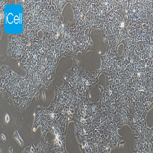 HCC827 人非小细胞肺癌细胞-原代细胞-STR细胞-细胞培养基-镜像绮点生物