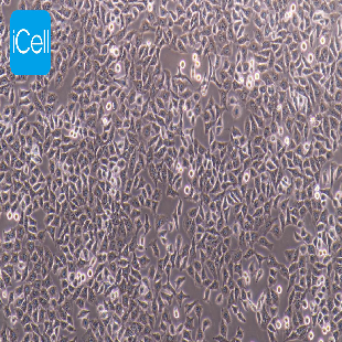 HCC-LM3 高转移人肝癌细胞-原代细胞-STR细胞-细胞培养基-镜像绮点生物