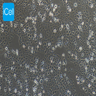 HEC-1-A 人子宫内膜腺癌细胞-原代细胞-STR细胞-细胞培养基-镜像绮点生物