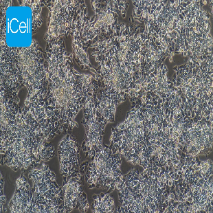 Hep G2 人肝癌细胞-原代细胞-STR细胞-细胞培养基-镜像绮点生物