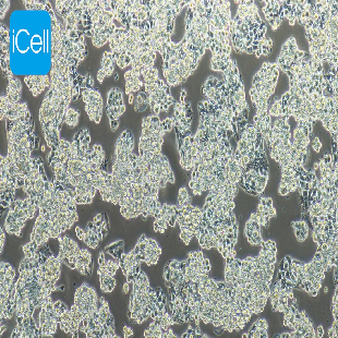 Hep G2.2.15 人肝母细胞瘤细胞-原代细胞-STR细胞-细胞培养基-镜像绮点生物