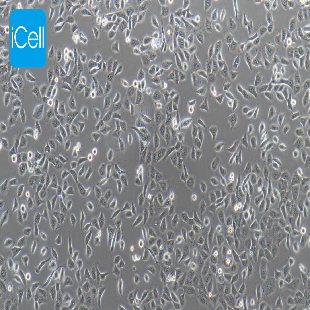 HPAC 人胰腺癌细胞-原代细胞-STR细胞-细胞培养基-镜像绮点生物