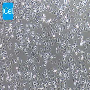 HPAC 人胰腺癌细胞-原代细胞-STR细胞-细胞培养基-镜像绮点生物