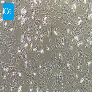HT-1080 人纤维肉瘤细胞-原代细胞-STR细胞-细胞培养基-镜像绮点生物