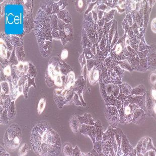 HT-1376 人膀胱癌细胞-原代细胞-STR细胞-细胞培养基-镜像绮点生物