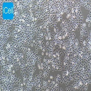 IOSE-80 人正常卵巢上皮细胞-原代细胞-STR细胞-细胞培养基-镜像绮点生物