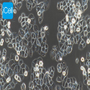 IOSE-80 人正常卵巢上皮细胞-原代细胞-STR细胞-细胞培养基-镜像绮点生物