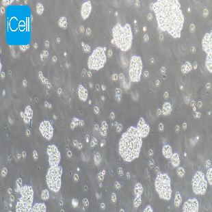 Jurkat（clone E6-1）人T淋巴细胞白血病细胞-原代细胞-STR细胞-细胞培养基-镜像绮点生物