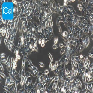 OVCAR-3 人卵巢腺癌细胞-原代细胞-STR细胞-细胞培养基-镜像绮点生物