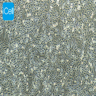 OV-90 人卵巢癌细胞-原代细胞-STR细胞-细胞培养基-镜像绮点生物